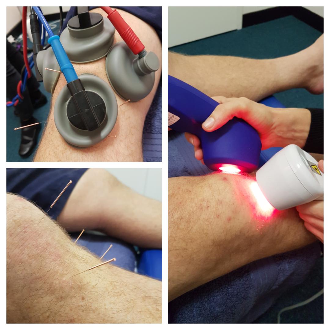 Runners Knee Knee pain solutions sports chiro | Joondalup, Perth ...